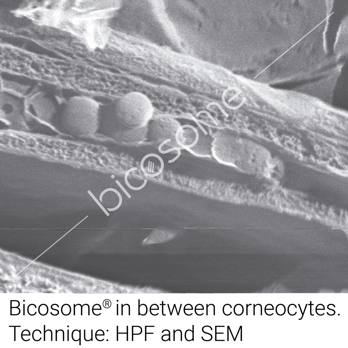 Technology - Bicosome